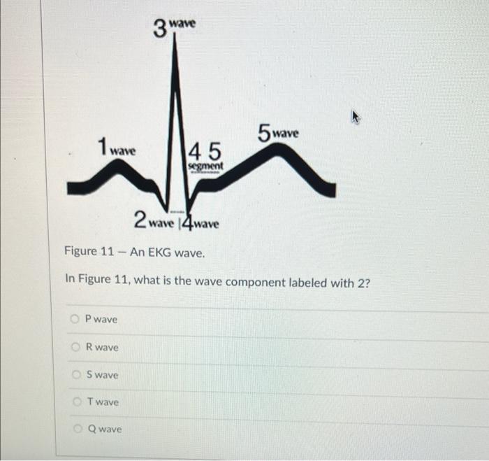 Solved 3 wave 5 wave I wave 45 segment 2w wave 4wave Figure | Chegg.com