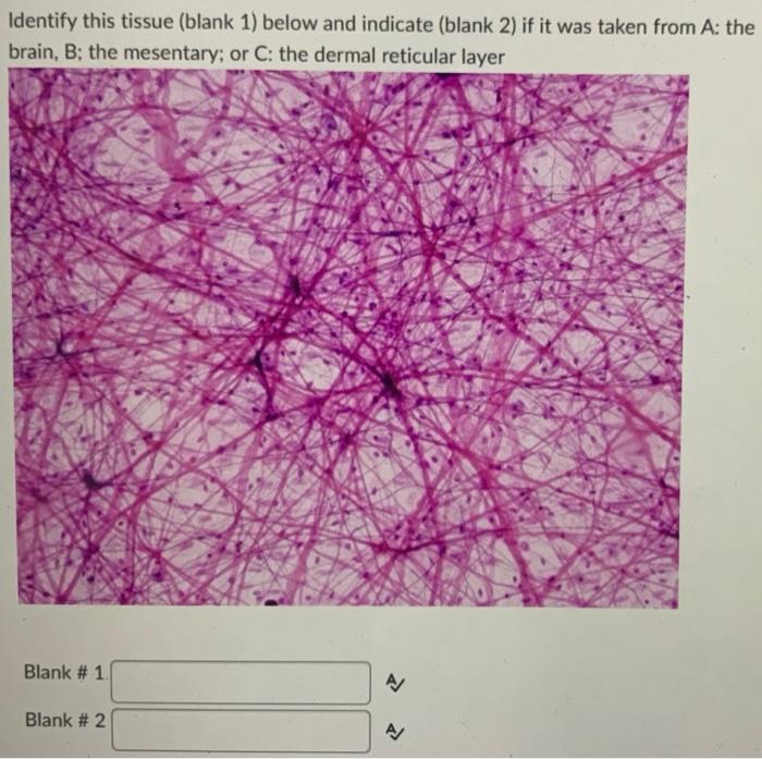 Solved Identify the tissues in this section: A = blank 1; B | Chegg.com