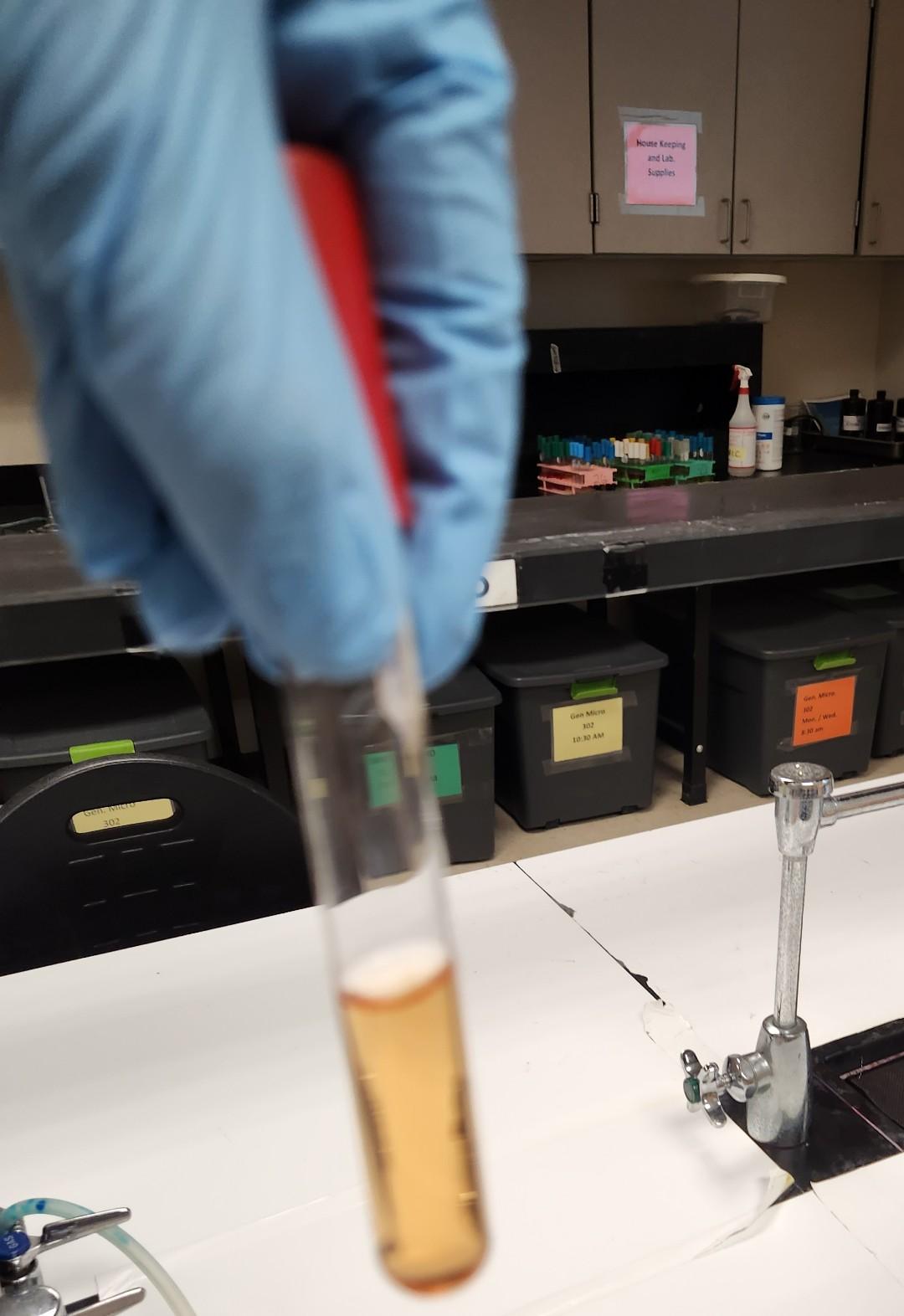 Solved Here are my results of an "H2S/Motility Test" and and | Chegg.com