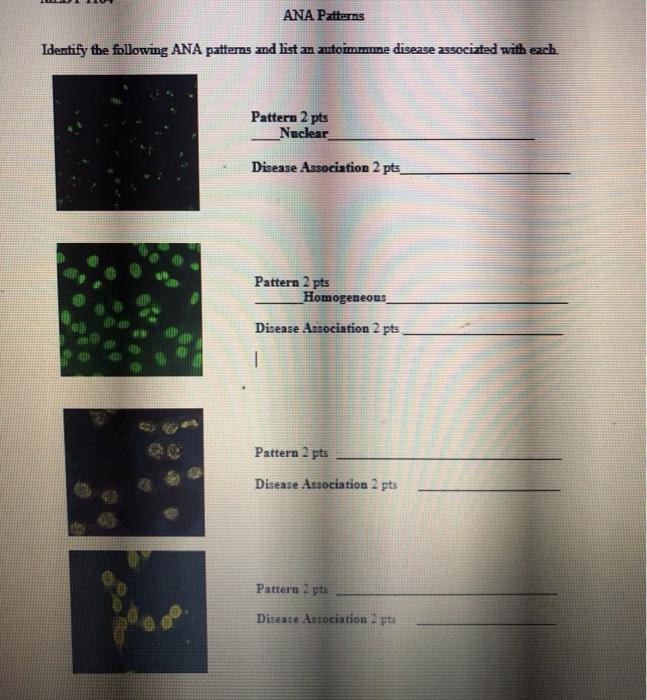 Solved ANA Patterns Identify the following ANA patterns and | Chegg.com