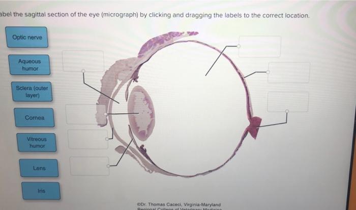 Solved abel the sagittal section of the eye (micrograph) by | Chegg.com