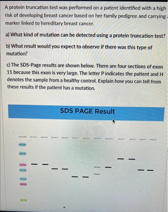 Solved A protein truncation test was performed on a patent | Chegg.com