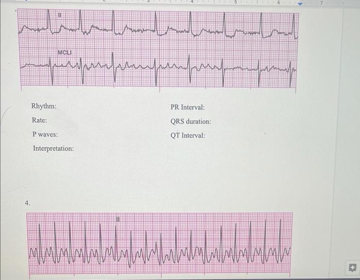 Solved مارال MCL rachenfummipumpun Rhythm: Rate: PR | Chegg.com