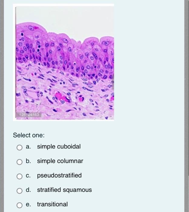 Solved Select one: a. simple cuboidal b. simple columnar c. | Chegg.com
