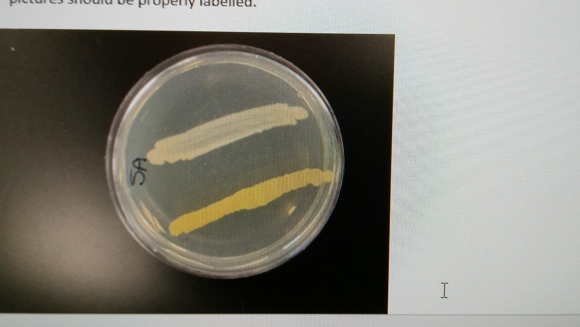 Solved I grew this on an msa plate is this S.epidermidis or | Chegg.com