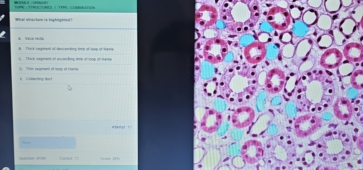 Solved MODULE: URINARYTOPIC : STRUCTURES I TYPE: | Chegg.com