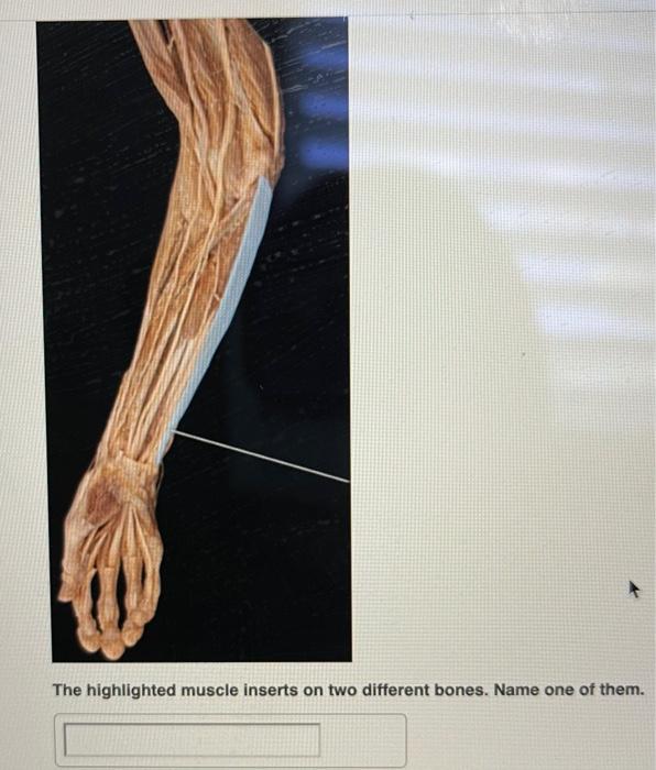 Solved Identify the highlighted muscle. The highlighted | Chegg.com Solved Identify the highlighted muscle. The highlighted | Chegg.com