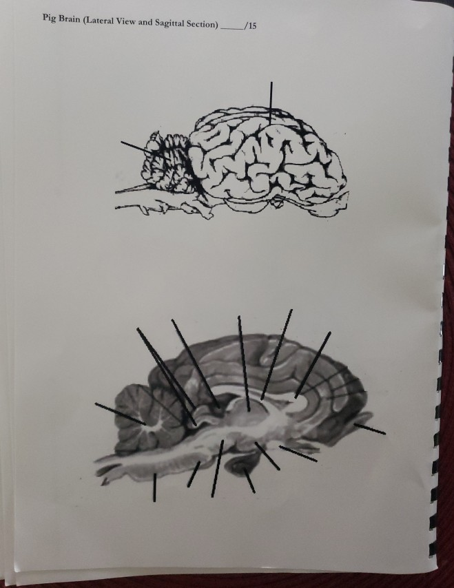 Solved Pig Cerebrum Cerebellum Midbrain Pons Medulla | Chegg.com
