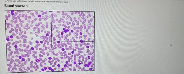 1. Using the blood smear image below count and | Chegg.com