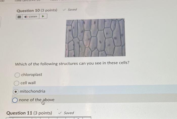 [Solved]: Which of the following structures can you see in