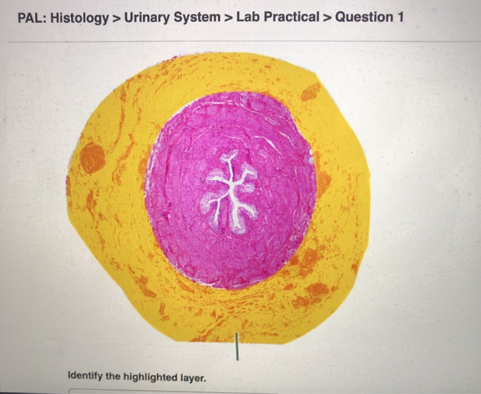 Solved PAL: Histology > Urinary System > Lab Practical > | Chegg.com