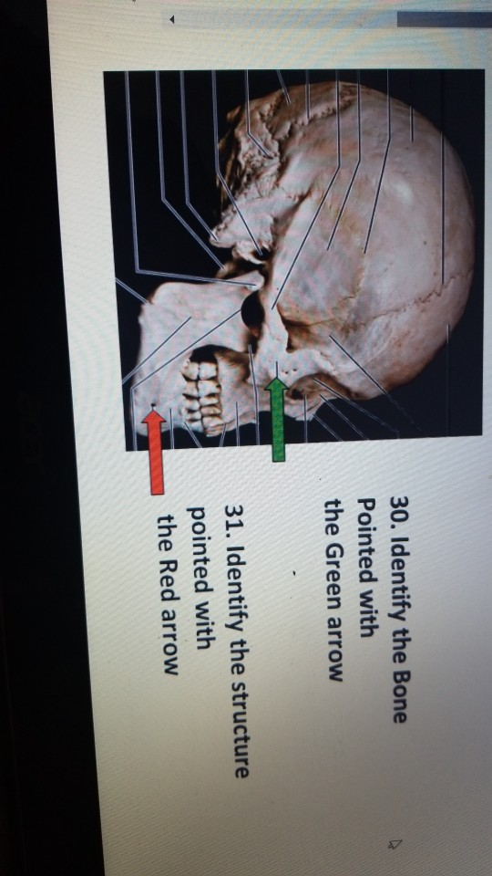 Solved 24. Identify the bone 25. Identify the bone marking | Chegg.com