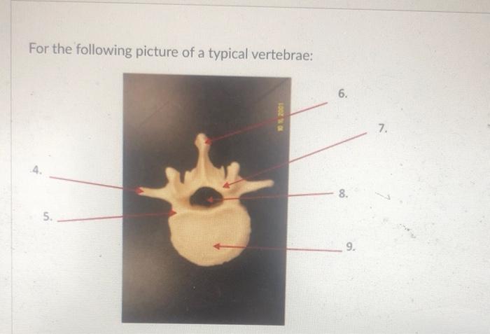 Solved For the following picture of a typical vertebrae. | Chegg.com
