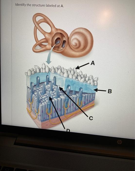 Solved Identify the structure labeled at A. | Chegg.com
