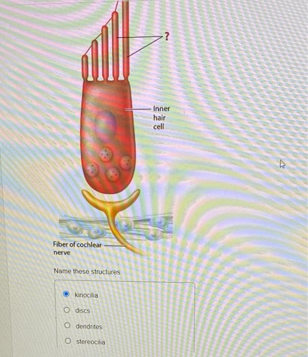 Solved Name these structures kinocilia discs dendrites | Chegg.com