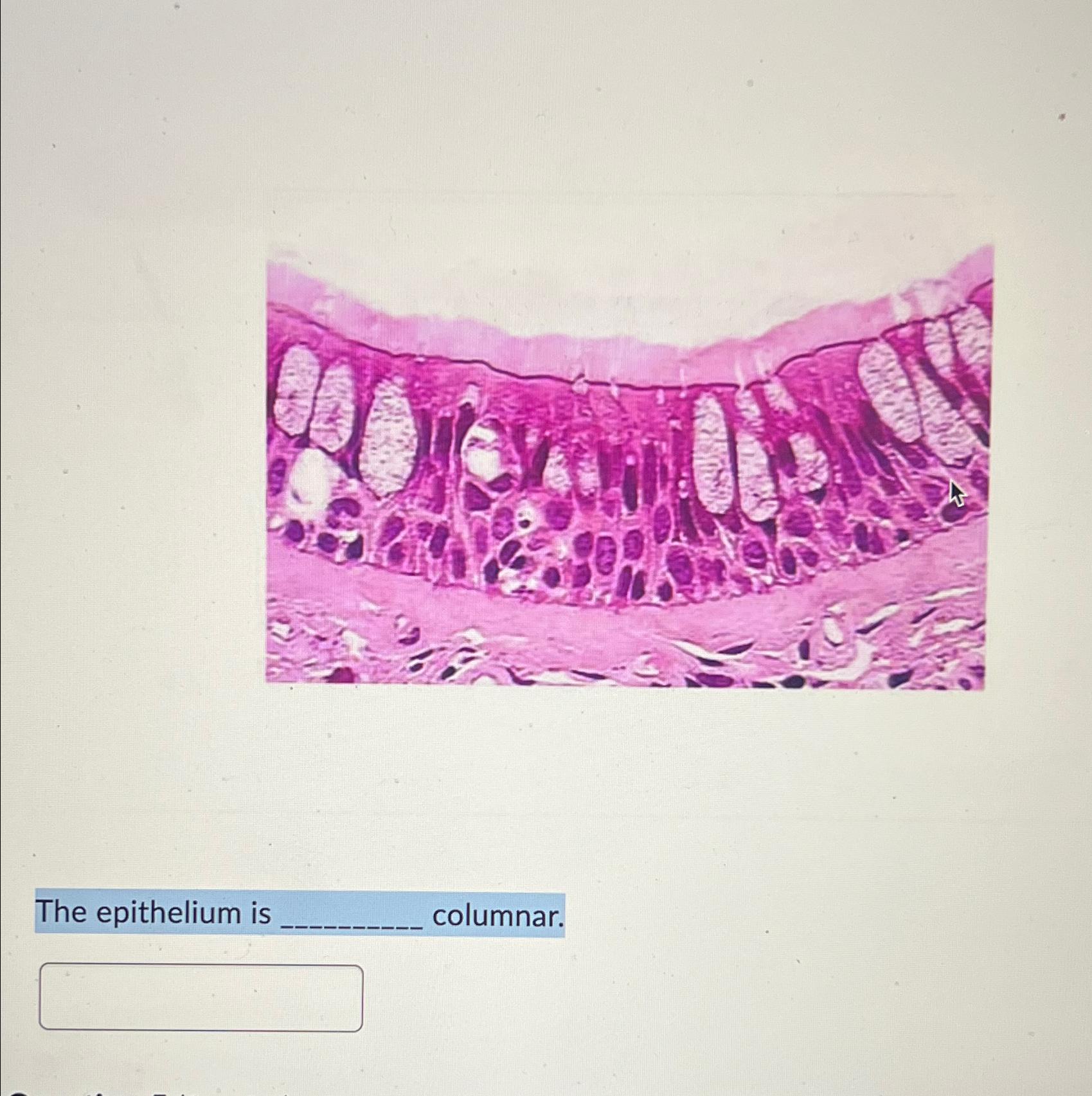 Solved The epithelium is columnar. | Chegg.com