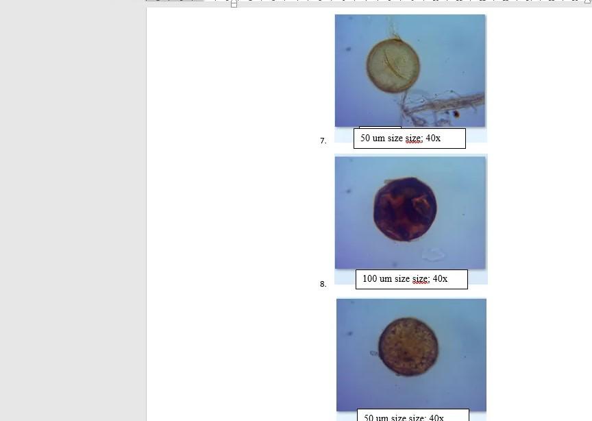 Solved Please determine the Genus (Glomus, Aucolospora, or | Chegg.com