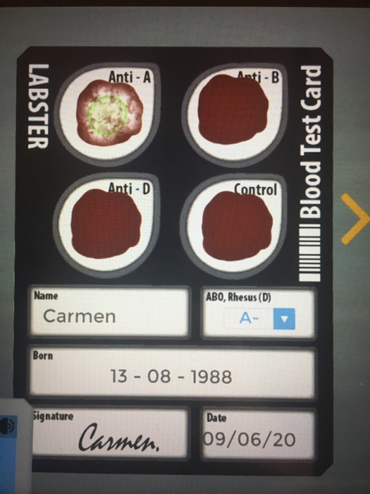 Anti-A Anti-B LABSTER Anti-D CODIDI Blood Test Card | Chegg.com