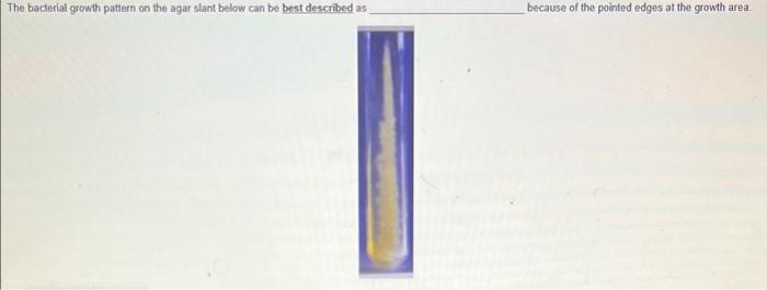 Solved The bacterial growth pattern on the agar slant below | Chegg.com