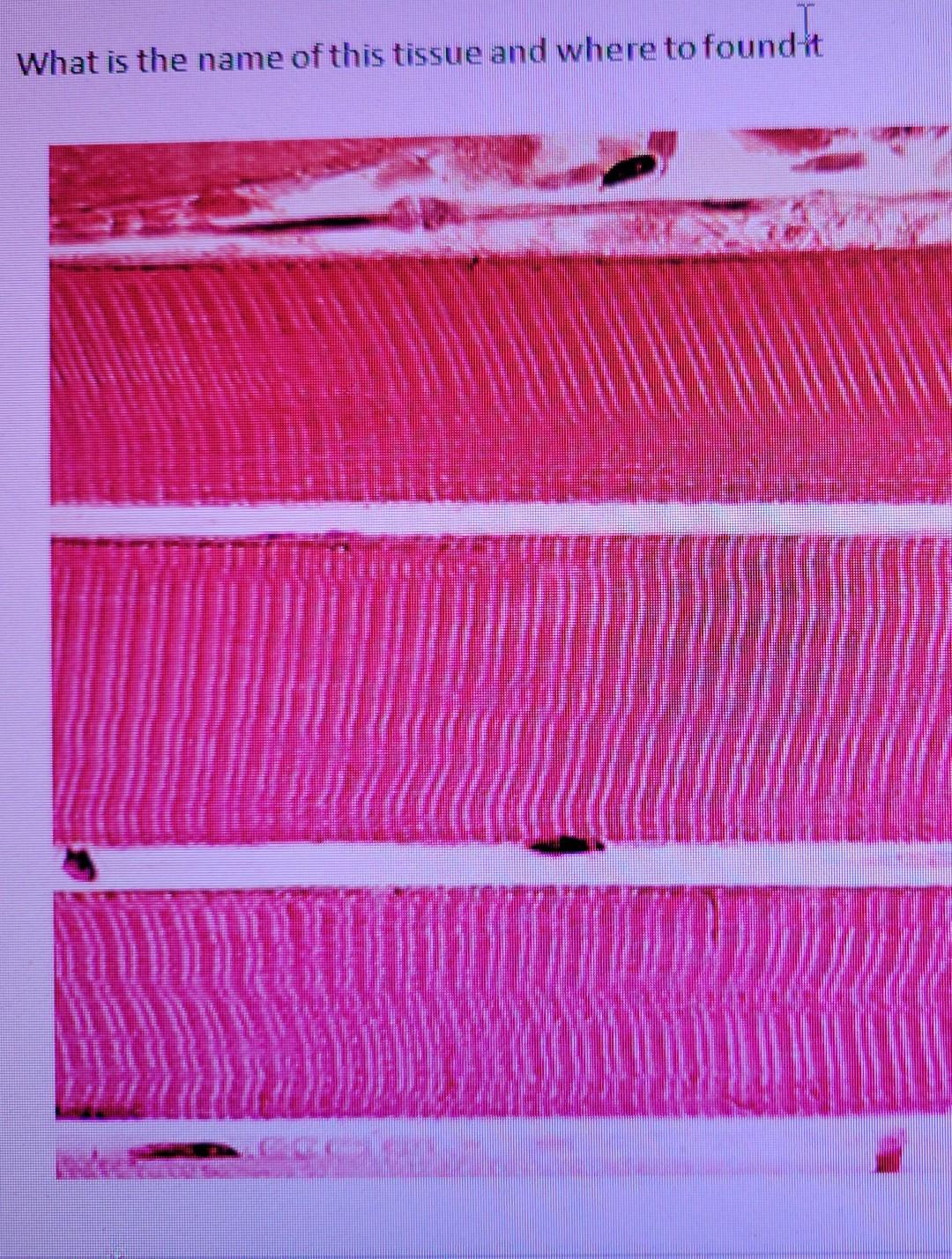 Solved What is the name of this tissue and where to found it | Chegg.com