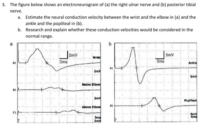 The figure below shows an electroneurogram of (a) the | Chegg.com