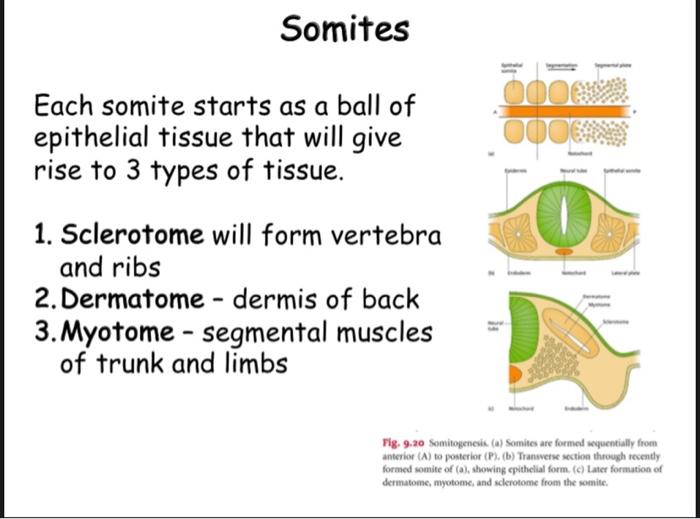 Solved Activity 2 1. What part of the somite gives rise to | Chegg.com