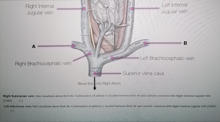 Solved Right Subclavian vein: Vein visualized above first | Chegg.com