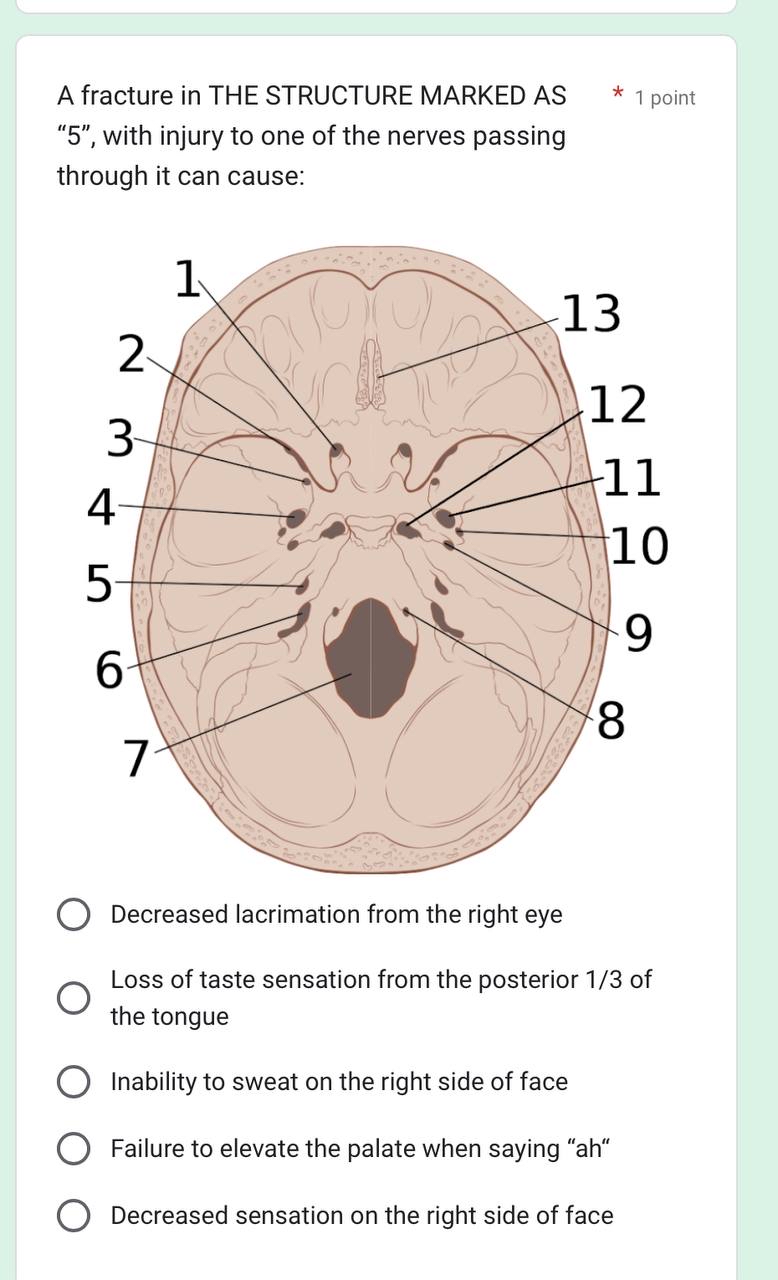 Solved A fracture in THE STRUCTURE MARKED AS1 ﻿point" 5 ", | Chegg.com