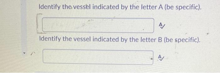 Solved B A-> Identify the vessel indicated by the letter A | Chegg.com