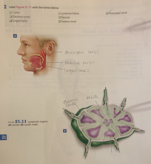 Solved 2 Label Figure 21.11 with the terms below. Cortex | Chegg.com
