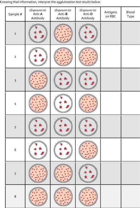 Solved Knowing that information, interpret the agglutination | Chegg.com