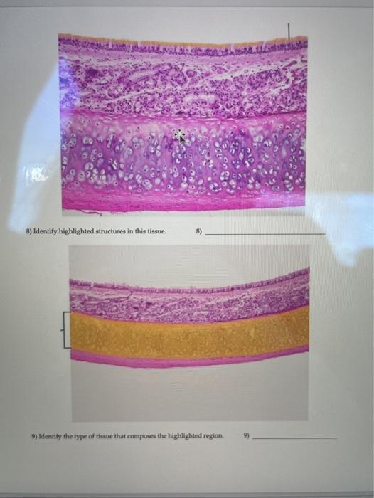 Solved 8) Identify highlighted structures in this tissue 9) | Chegg.com