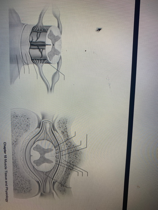 Solved Chapter 10 Muscle Tissue and Physiology | Chegg.com
