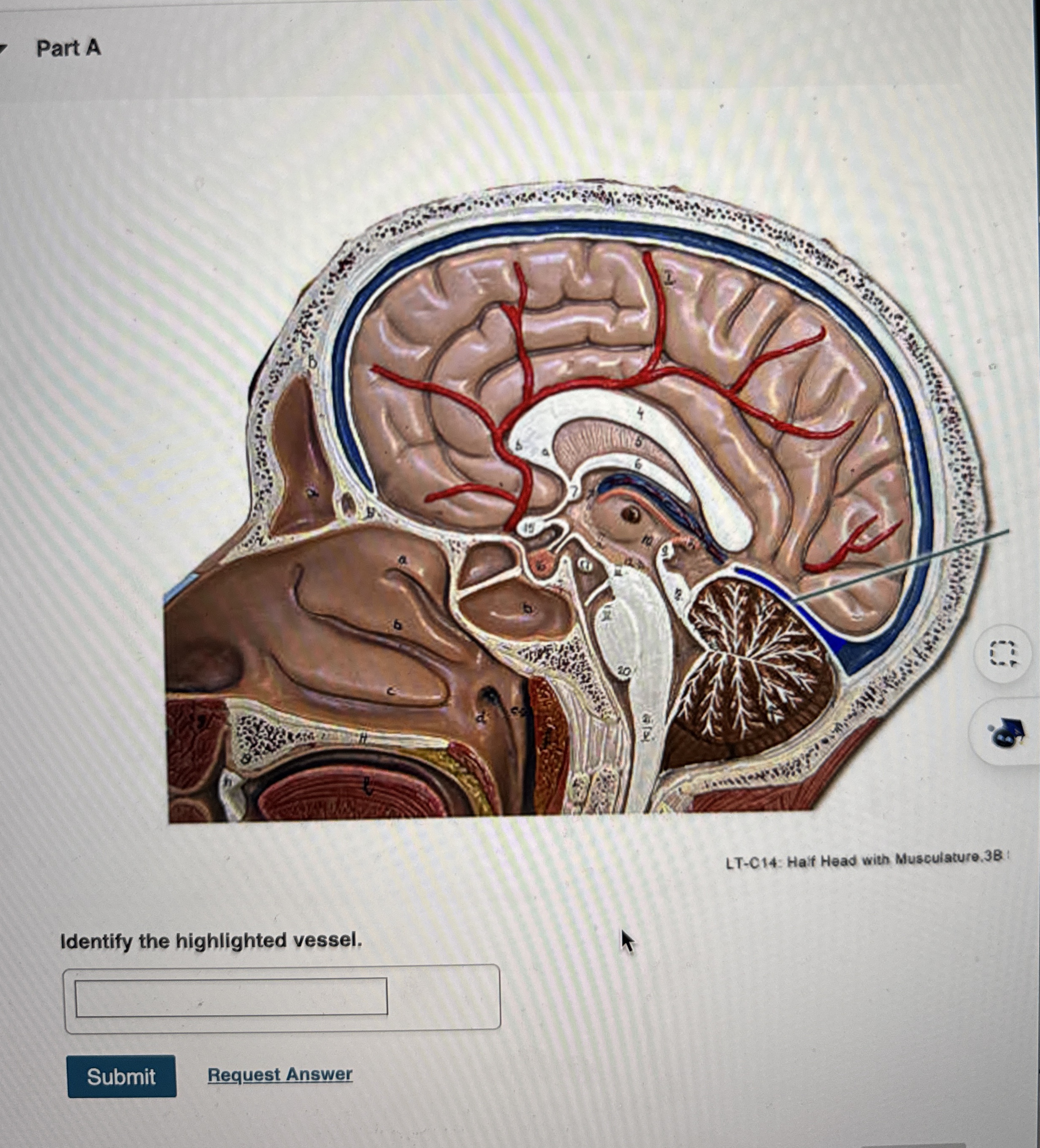 Part ALT-C14: Haif Head with Musculature.38:Identify | Chegg.com