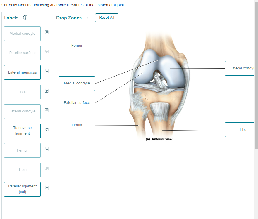 Solved Correctly label the following anatomical features of | Chegg.com