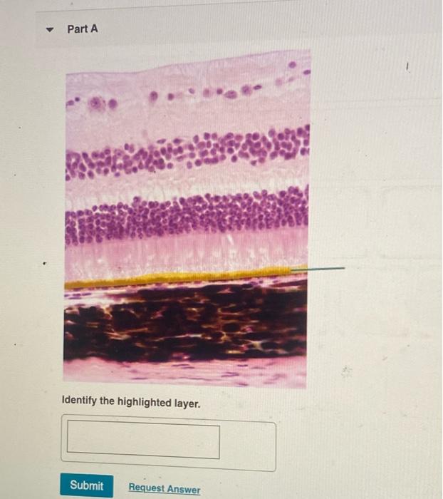 Solved Part A Name the fluid found in the highlighted | Chegg.com