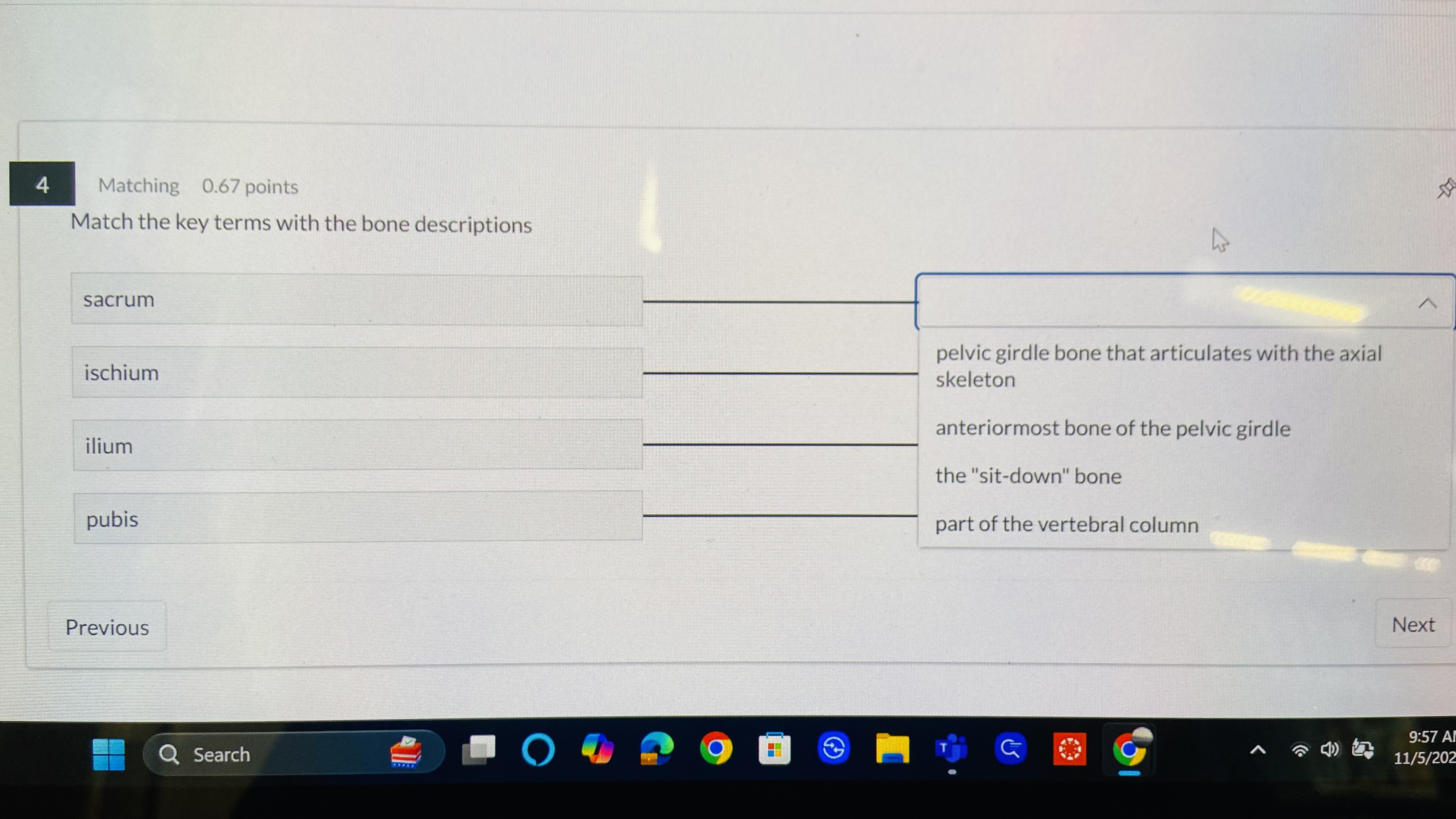 Solved Match the key terms with the bone | Chegg.com