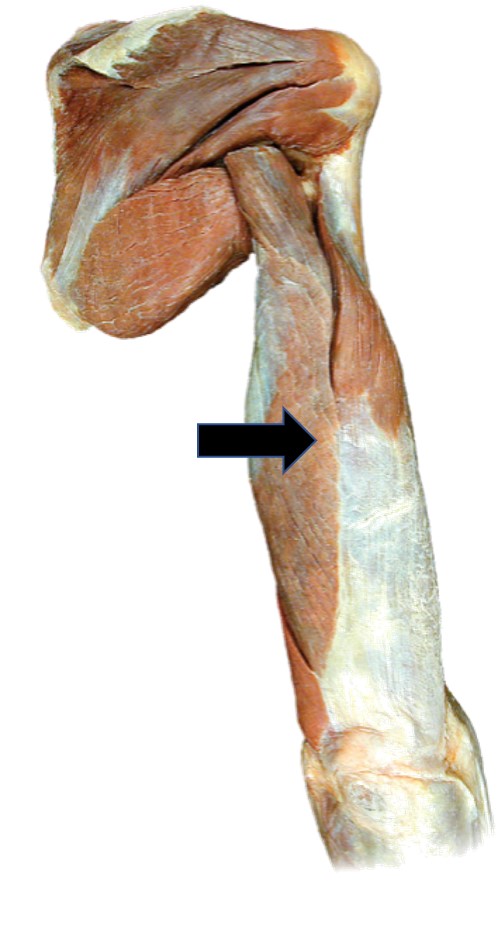 The muscle indicated by ﻿the arrow is ﻿named after | Chegg.com