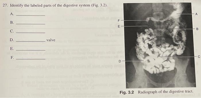 Solved 27. Identify the labeled parts of the digestive | Chegg.com