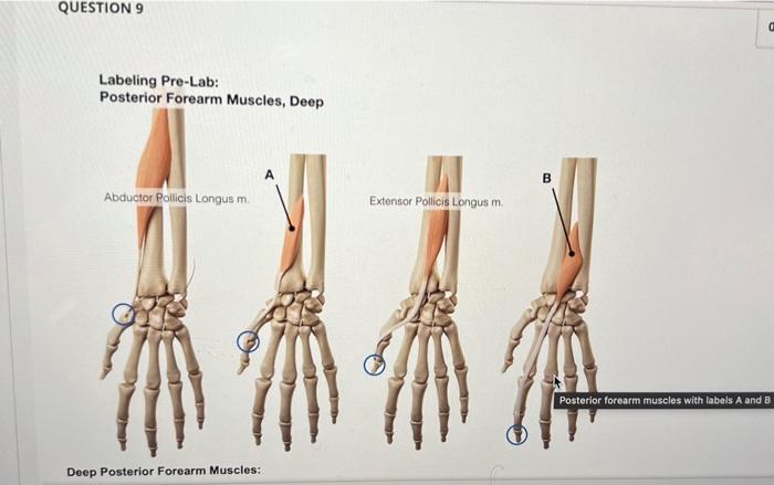 Solved QUESTION 8 Labeling Pre-Lab: Posterior Forearm | Chegg.com