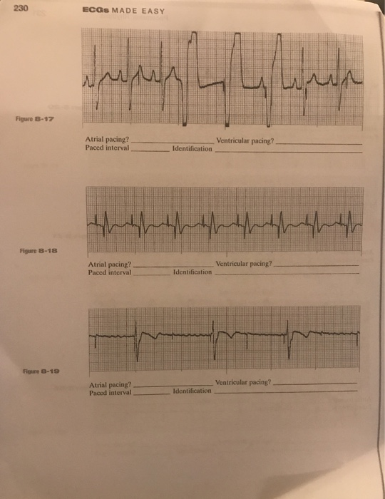 Atrial Pacing