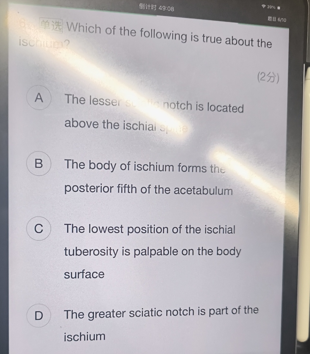 Solved 倒计时 49:08Which of the following is true about the | Chegg.com