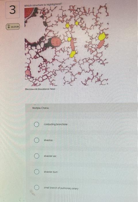 Which structure is highlighted? 3 8 00:33:30 | Chegg.com