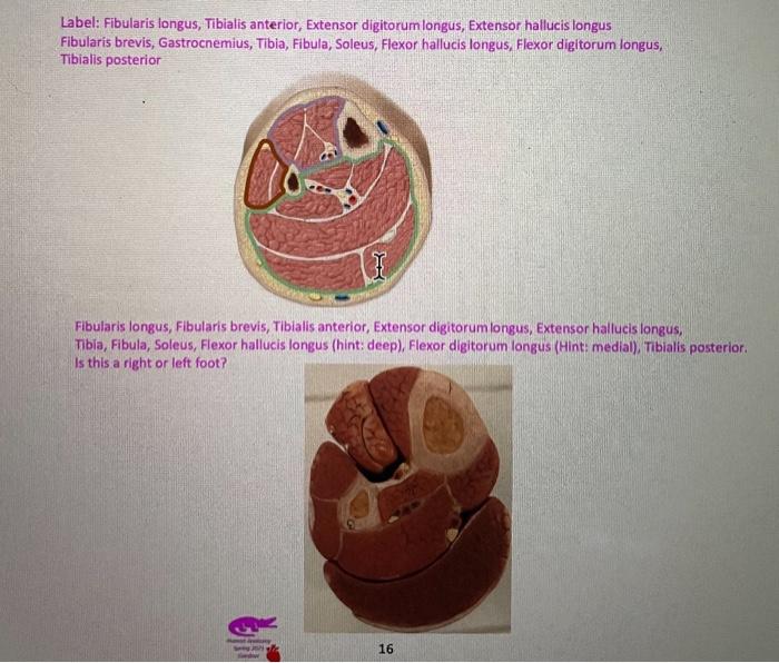 Solved Label: Fibularis longus, Tibialis anterior, Extensor | Chegg.com