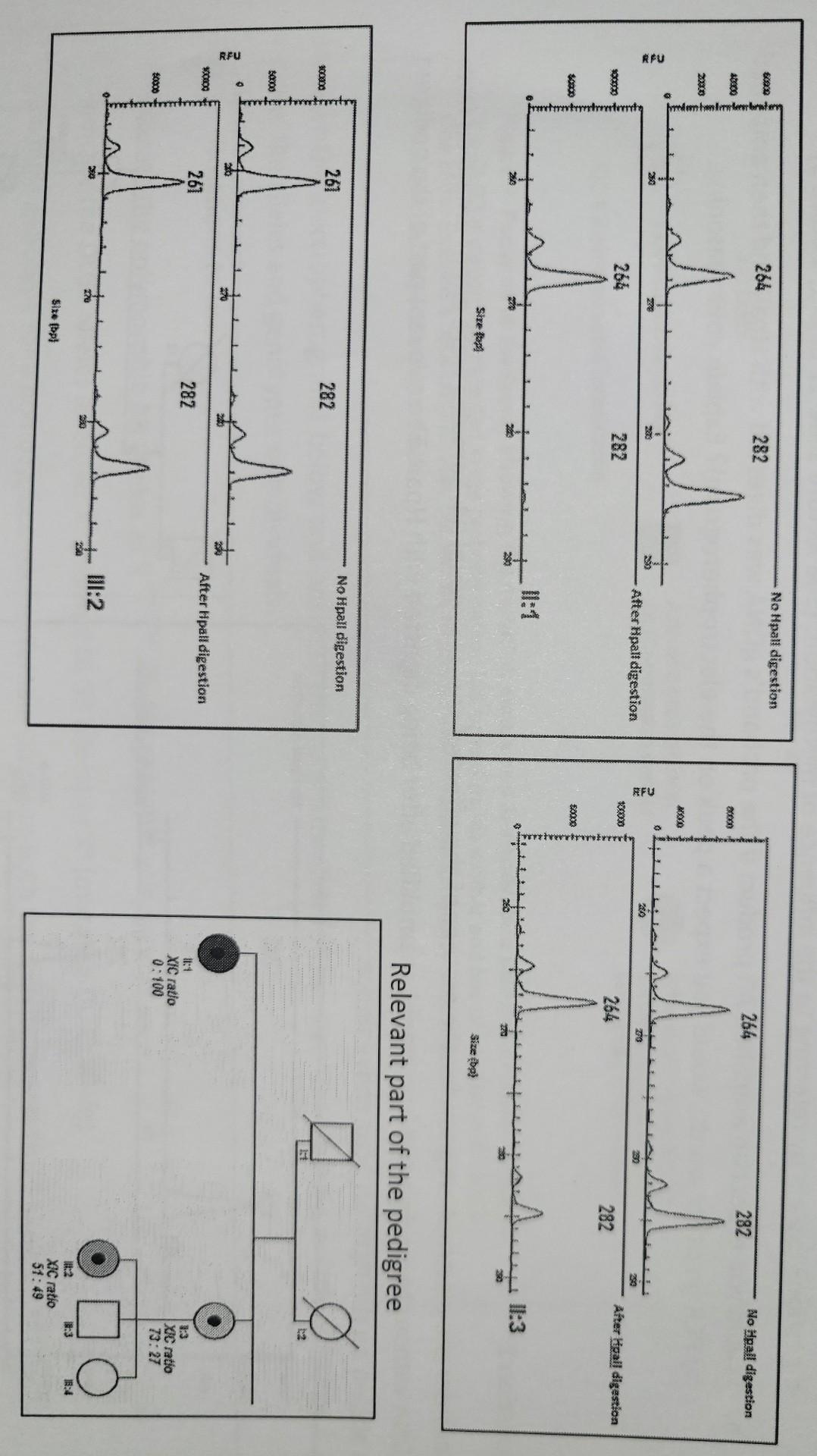 Solved The electropherograms below show the HUMARA assay | Chegg.com