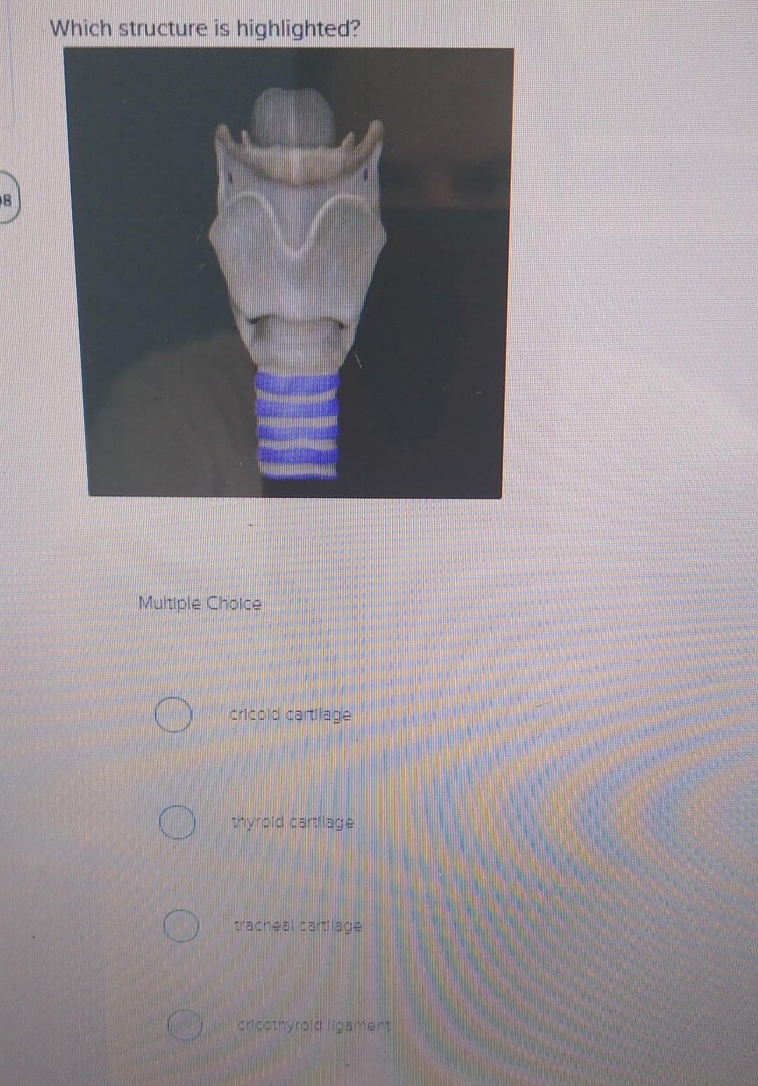 Solved Which structure is highlighted? Multiple Chorge | Chegg.com