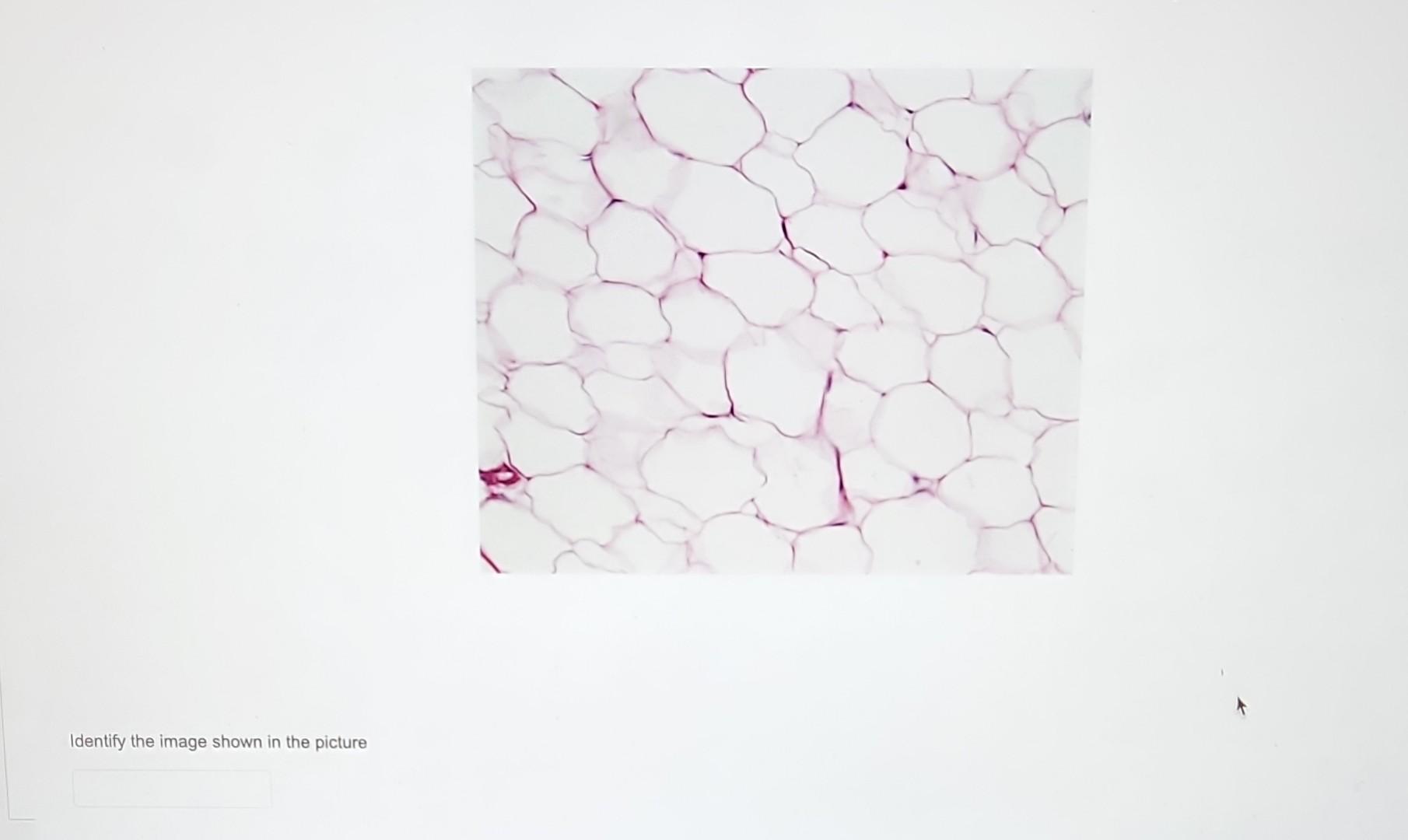 Solved Identify the image shown in the picture | Chegg.com