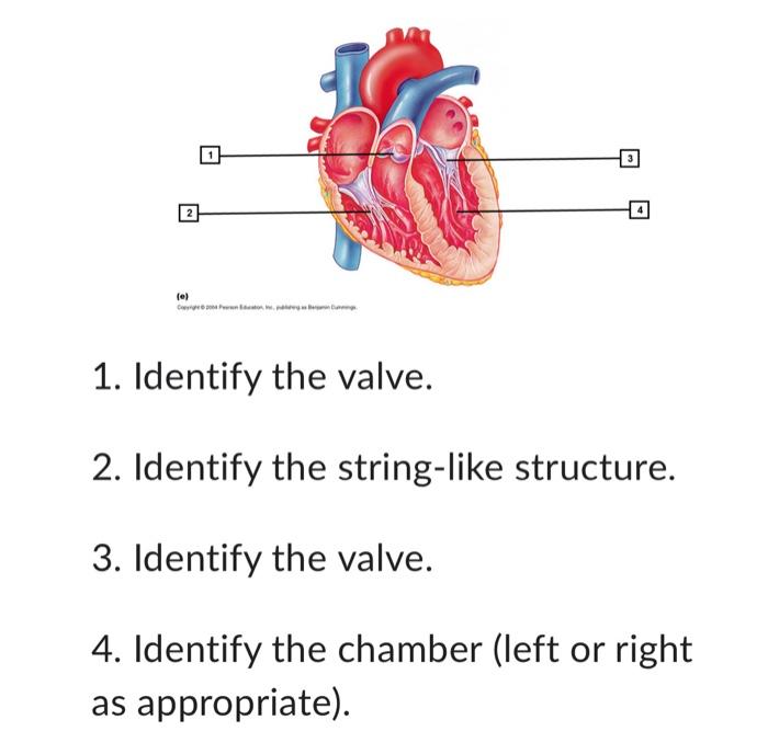 Solved 1. Identify the valve. 2. Identify the string-like | Chegg.com