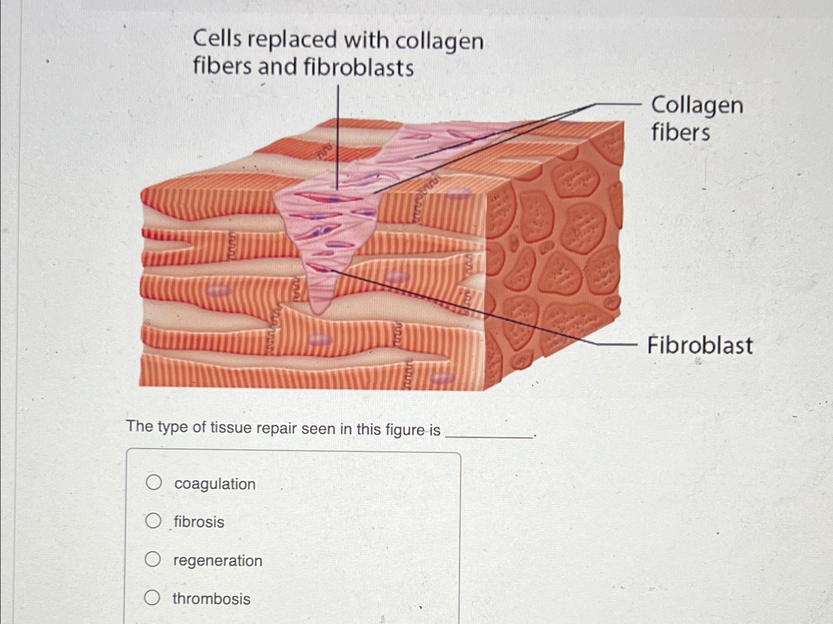 Solved Cells replaced with collagen fibers and | Chegg.com