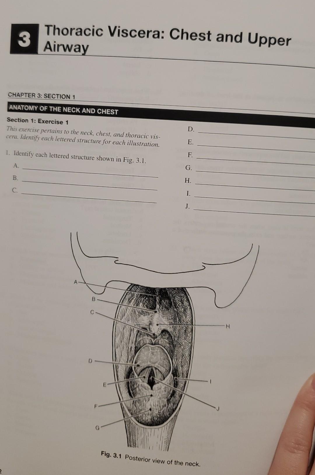 Solved Thoracic Viscera: Chest and Upper Airway CHAPTER 3: | Chegg.com
